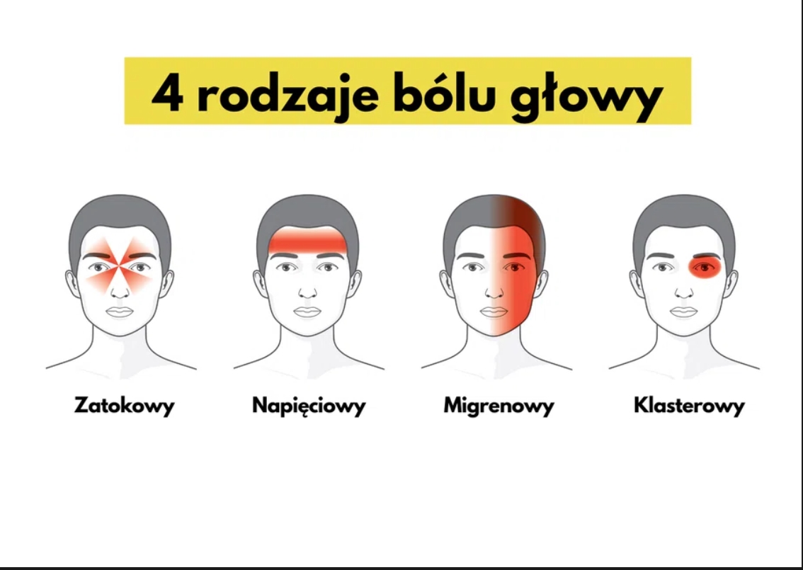 Ból głowy - przyczyny i leczenie | nazdrowo.pl